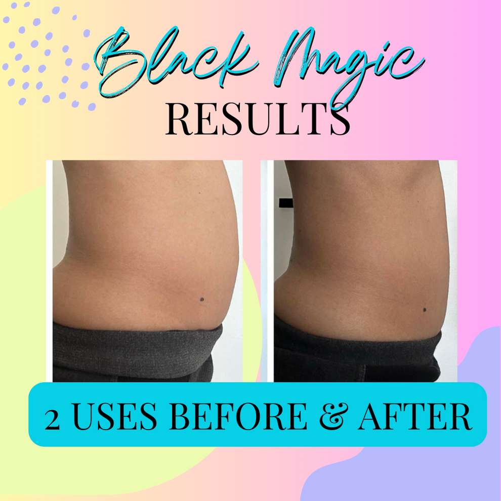 Black Magic – Bodynovas